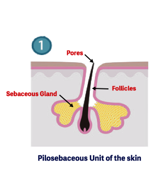 Acne Treatment Malaysia | Acne Treatment Options - Malaysia Aesthetic